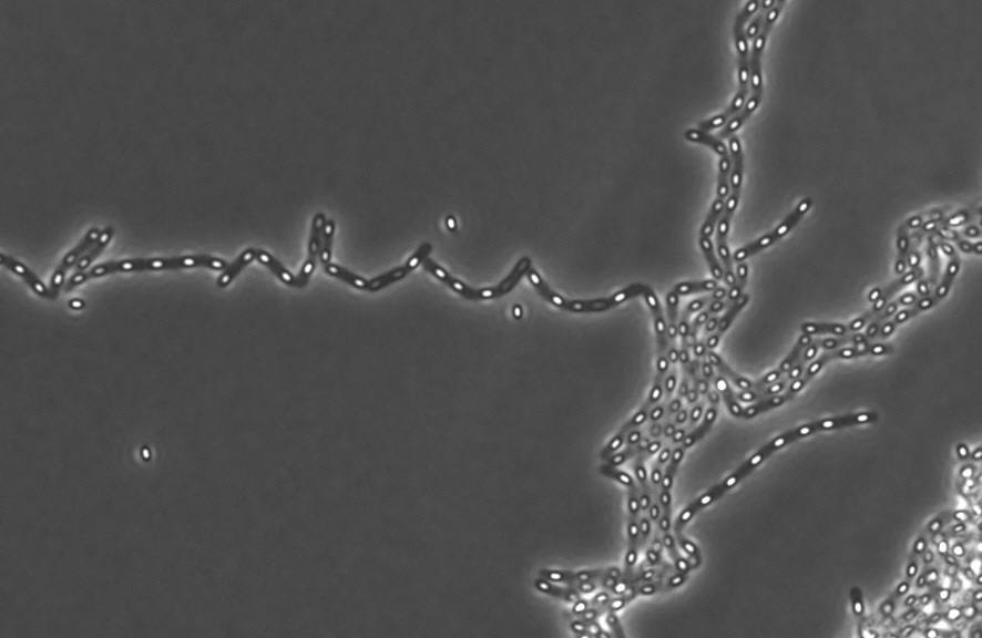 Of Bacteria and Men: Filamentous bacteria under the microscope