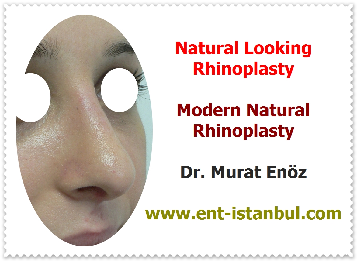 Natural Rhinoplasty in Istanbul, Turkey