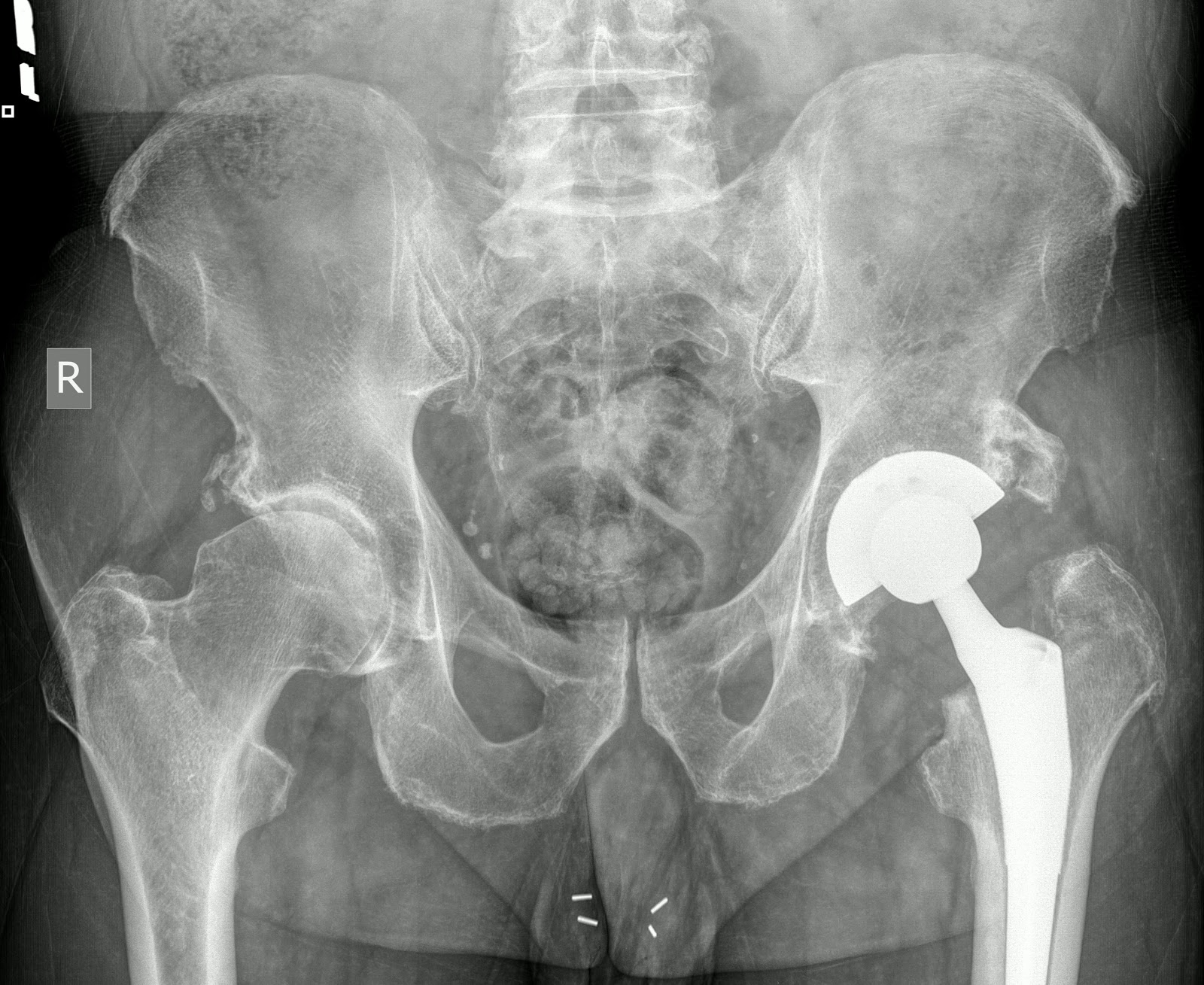 Patient's Progress: Dr. Dennis Burke: How My Longtime Surgeon Is Making ...