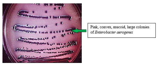 Spread Plate Method | Learn Microbiology