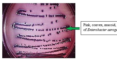 Spread Plate Method | Learn Microbiology