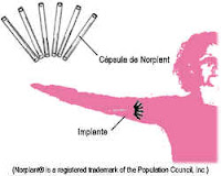 METODOS ANTICONCEPTIVOS: ¿QUÉ SON LOS MÉTODOS ANTICONCEPTIVOS Y CUÁLES ...
