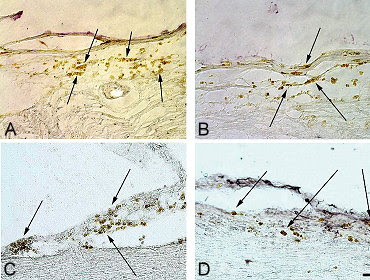 Neuromics: Neuron-specific class III beta-tubulin (TuJ1) Staining in ...