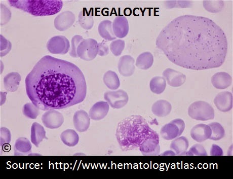 Lab Atlas: Megalocyte