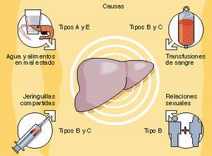 EL ESPACIO PARA BELLEZA Y BIENESTAR DE MARTHA: HEPATITIS: TRATAMIENTO ...