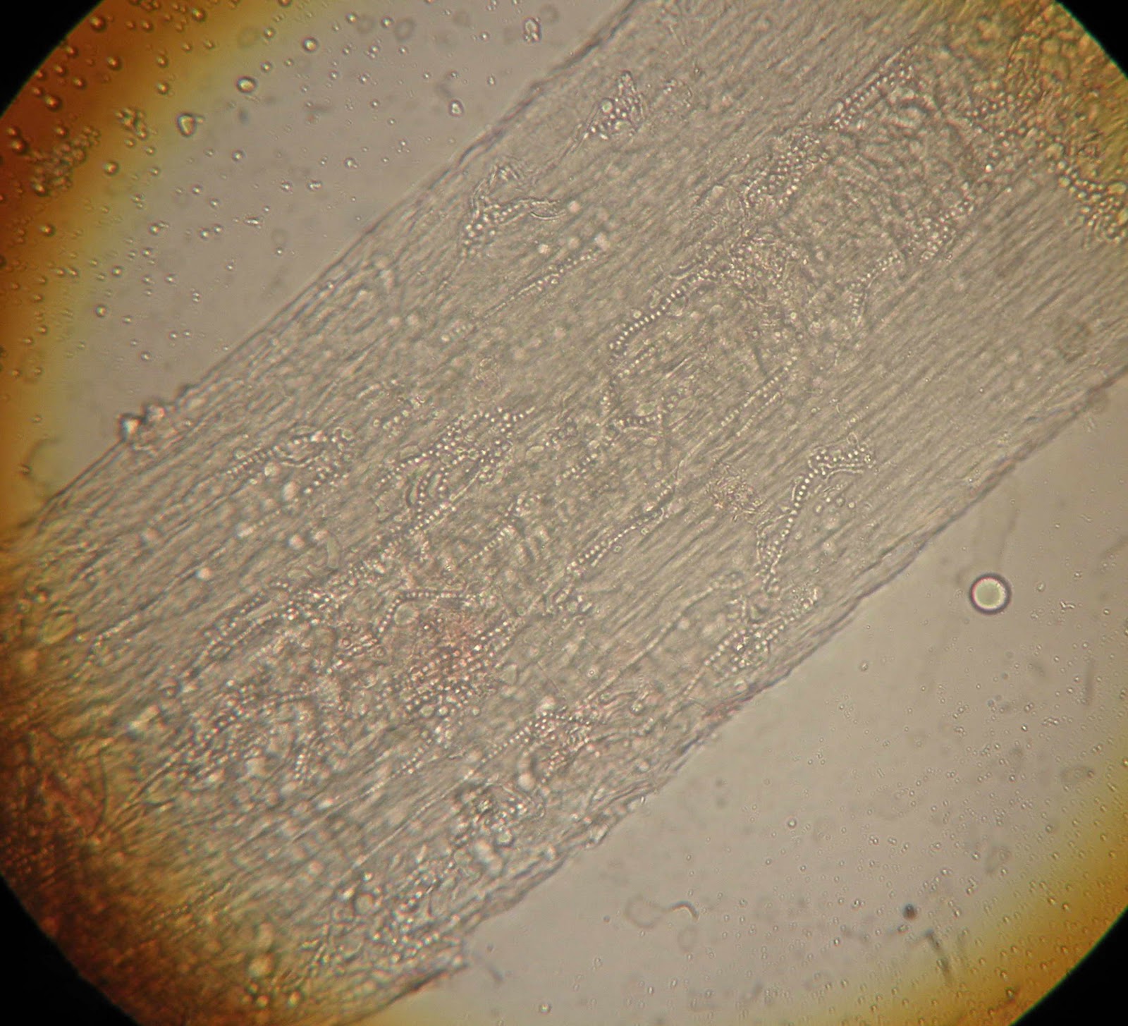 ATLAS MICOLOGIA: SICOSE POR TRICHOPHYTON MENTAGROPHYTES