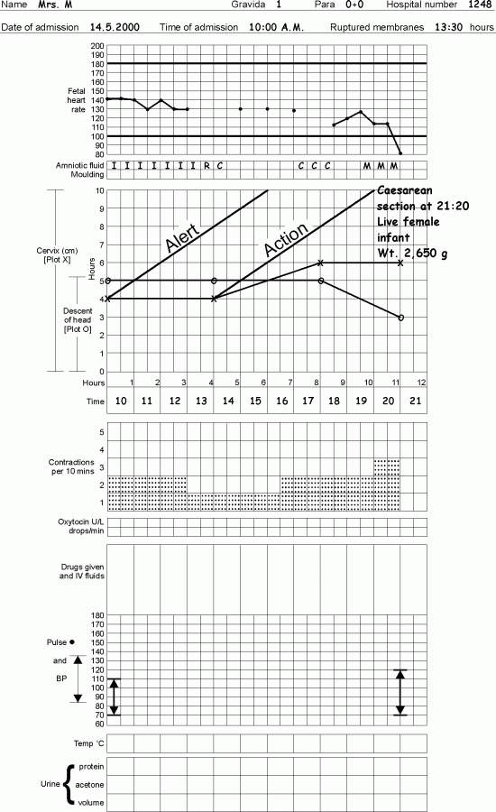 Partograf Normal dan Tidak Normal | Jurnal Bidan Diah