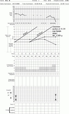 Partograf Normal Dan Tidak Normal | Jurnal Bidan