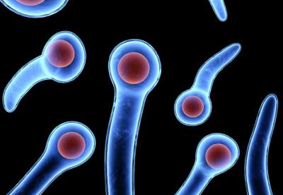 5 Hal yang Harus Anda Ketahui Tentang Penyakit Tetanus | Suara Kesehatan