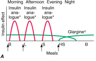 Best insulin regimen