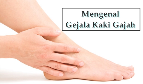 Mengenal Gejala Kaki Gajah Yang Harus Diwaspadai Sejak Dini - PUSAT ...
