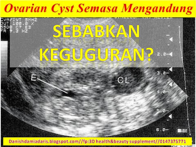 3D health beauty supplement: OVARIAN CYST KETIKA HAMILBOLEH SEBABKAN ...