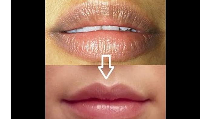 Info Tentang Kesehatan Dan Obat Tradisional: Wow !!! Mudah Sekali Untuk ...