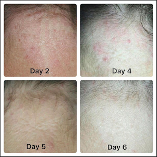 Your Wise Investment: GCOOP Handmade Sulfur Soap highly commanding for ...