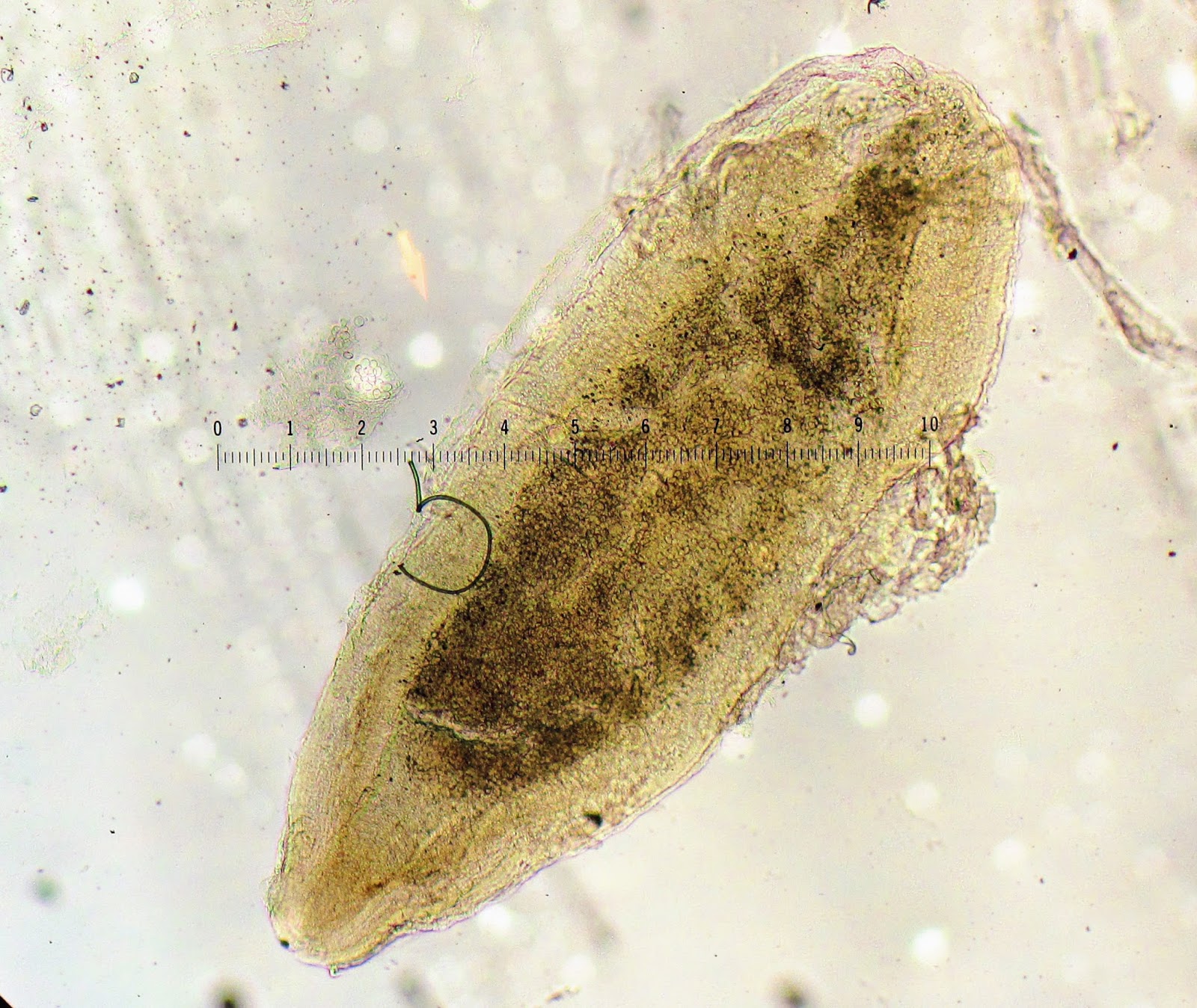 Creepy Dreadful Wonderful Parasites: Case of the Week 440