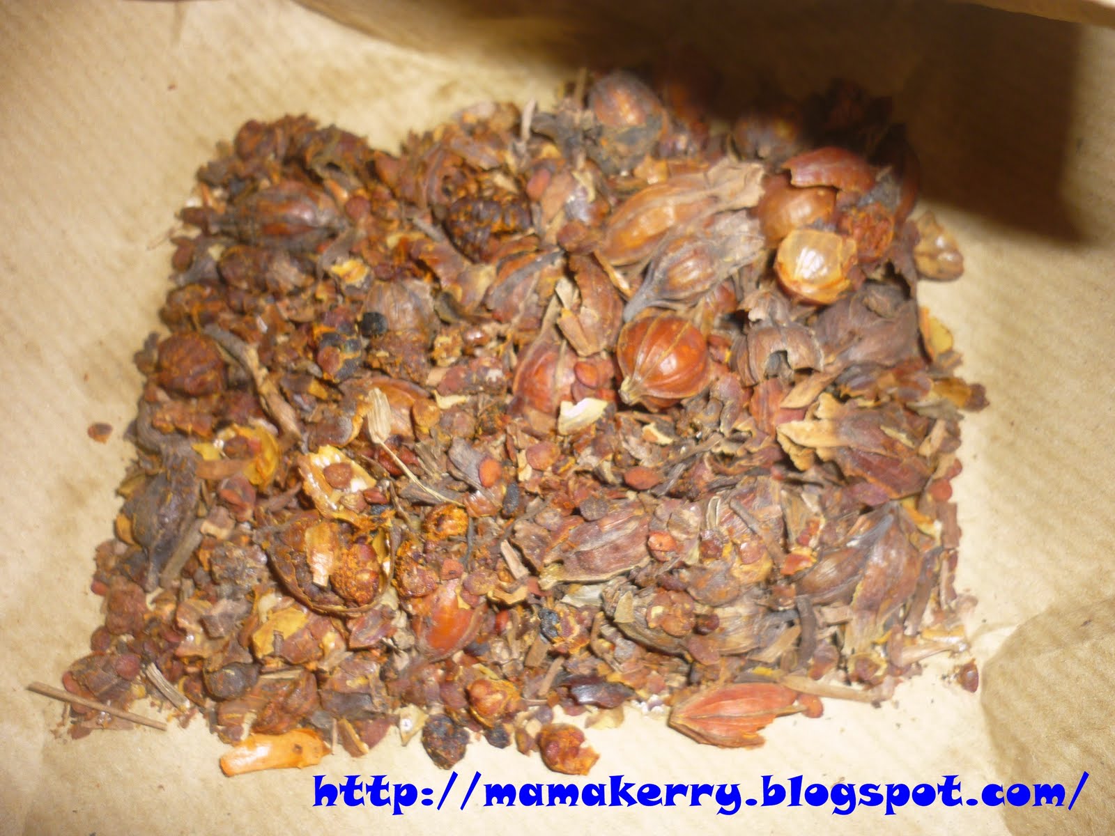 Sweetmama: Memori 3 Hari ZiQrY @ Wad NICU dan Kisah ZiQrY & Jaundis