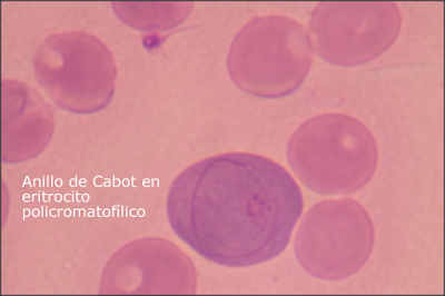 FICHERO DE HEMATOLOGIA: ANILLOS DE CABOT
