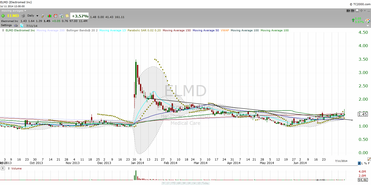 UPstocks - Trading the charts!