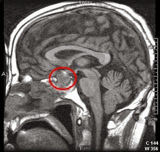 silla turca archivos