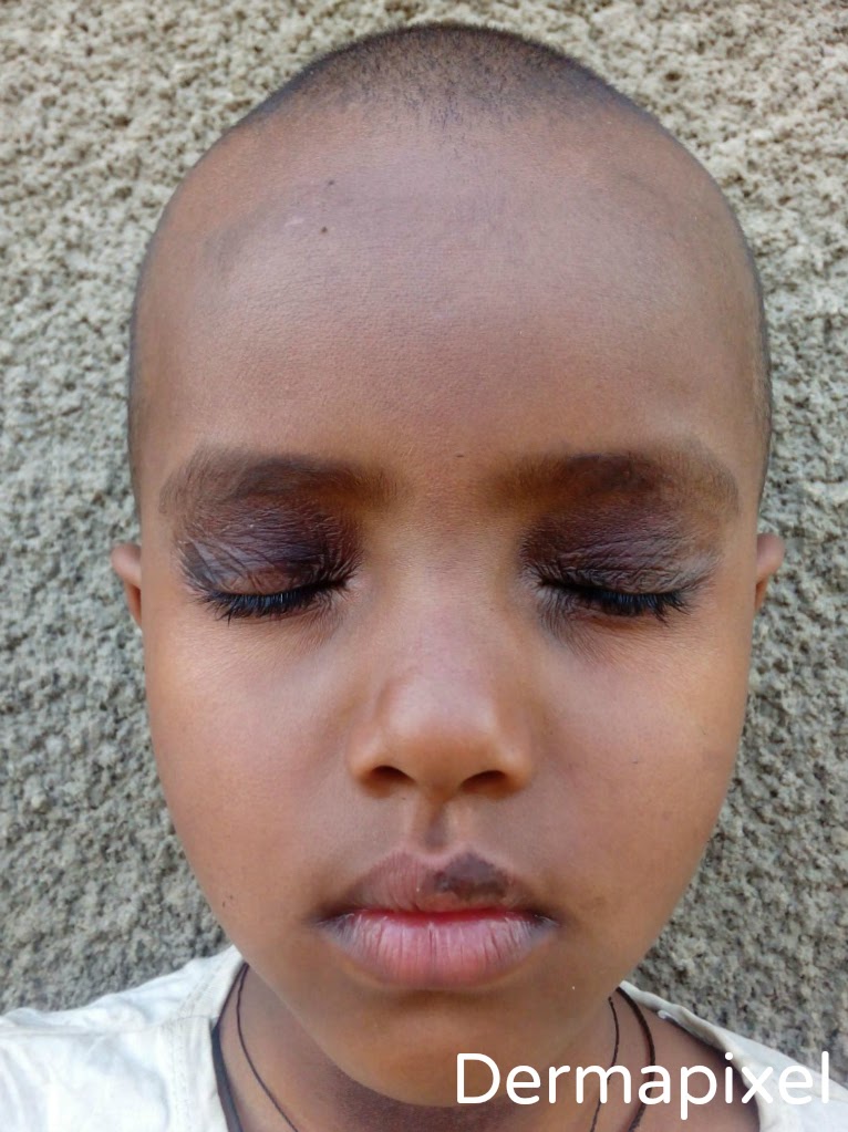 Dermapixel: agosto 2017