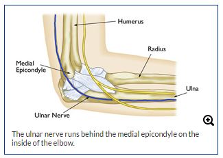 Living with Kennedy's Disease: Pinky Pain