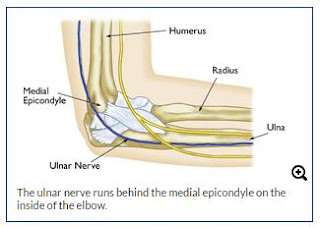 Living with Kennedy's Disease: Pinky Pain
