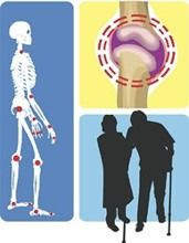 Infection Cancer: Skeletal System Diseases