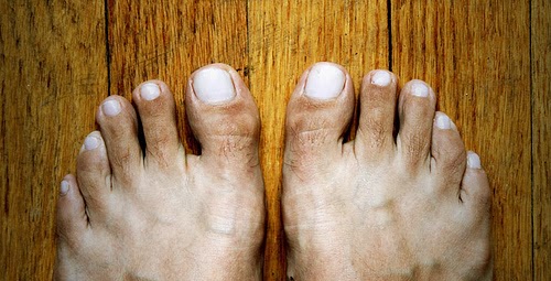 VittoriFootAnkleSpecialist: Changes in Toenails