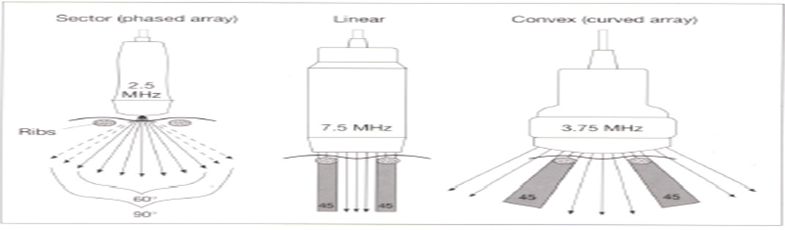 radiologi oh radiologi: USG ( ultrasonography)
