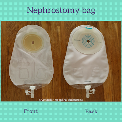 So, what is a nephrostomy?