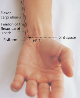 Ht 7. Shenmen / Sen Men (Pintu Gerbang Jiwa) - Terapi Jarum