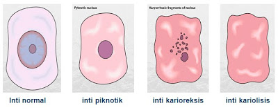 NEKROSIS - Iswary Halwadini