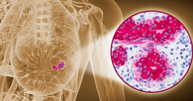 #Papo10: Dor no seio: o que pode ser? Veja 7 causas mais comuns