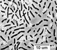 randhika khairunnisa: CHLOROBIUM SI BAKTERI FOTOSINTESIS