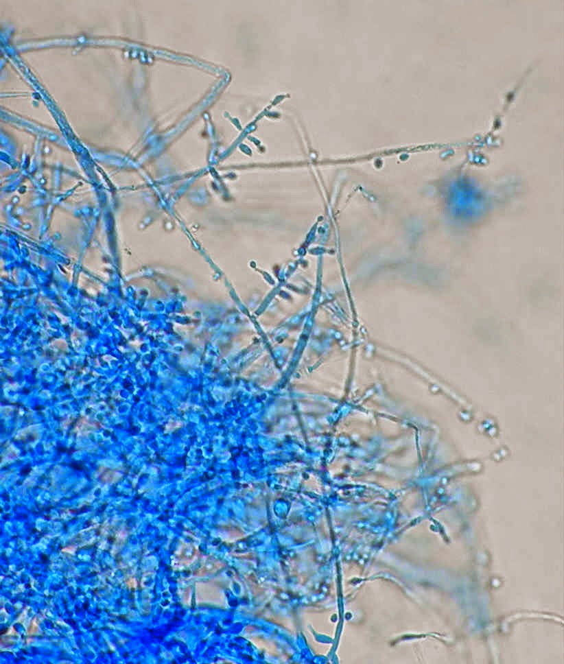 ATLAS MICOLOGIA: TRICHODERMA VIRIDE