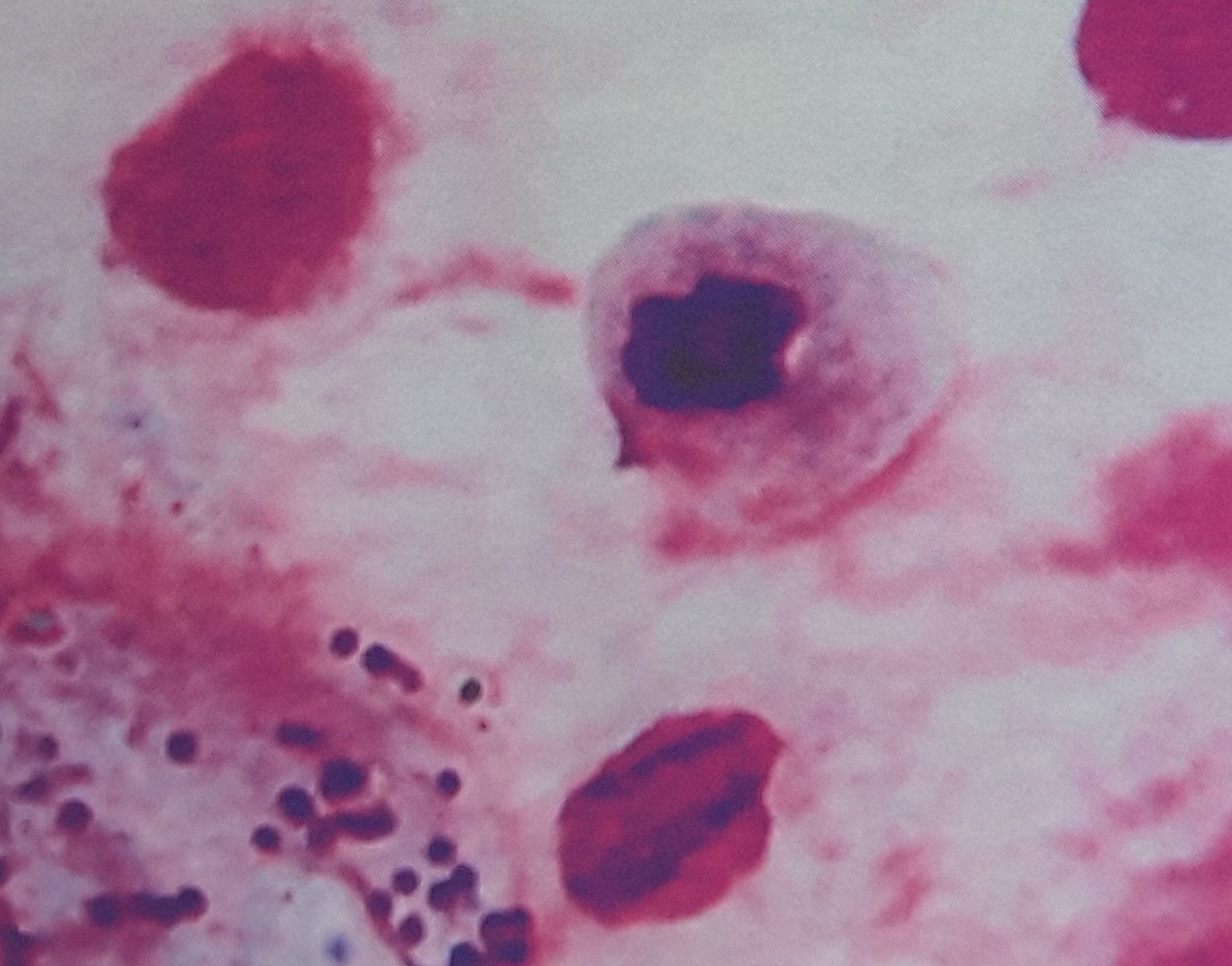 Citograma : 02/15/18