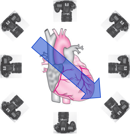 Urgencias y emergencias: Las derivaciones del electrocardiograma (I)