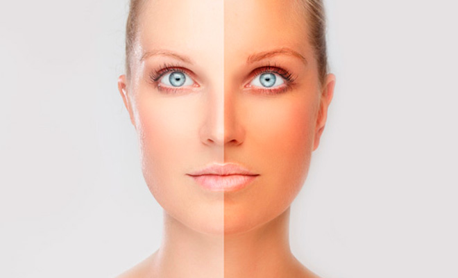 Beauty Channel: SUNTAN REMOVAL