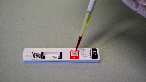 Apa itu CD4? | Infeksi Sexual - Imad Analis Blog