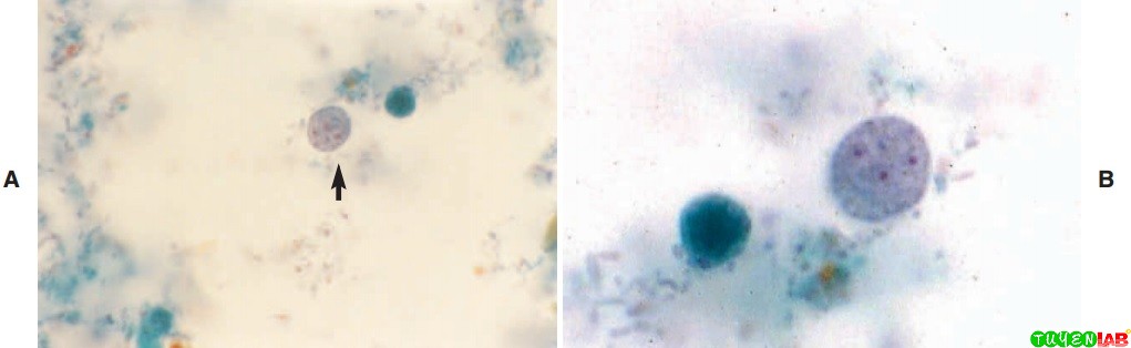 [Parasitology] Atlas of Diagnostic Parasitology | Free Medical Atlas