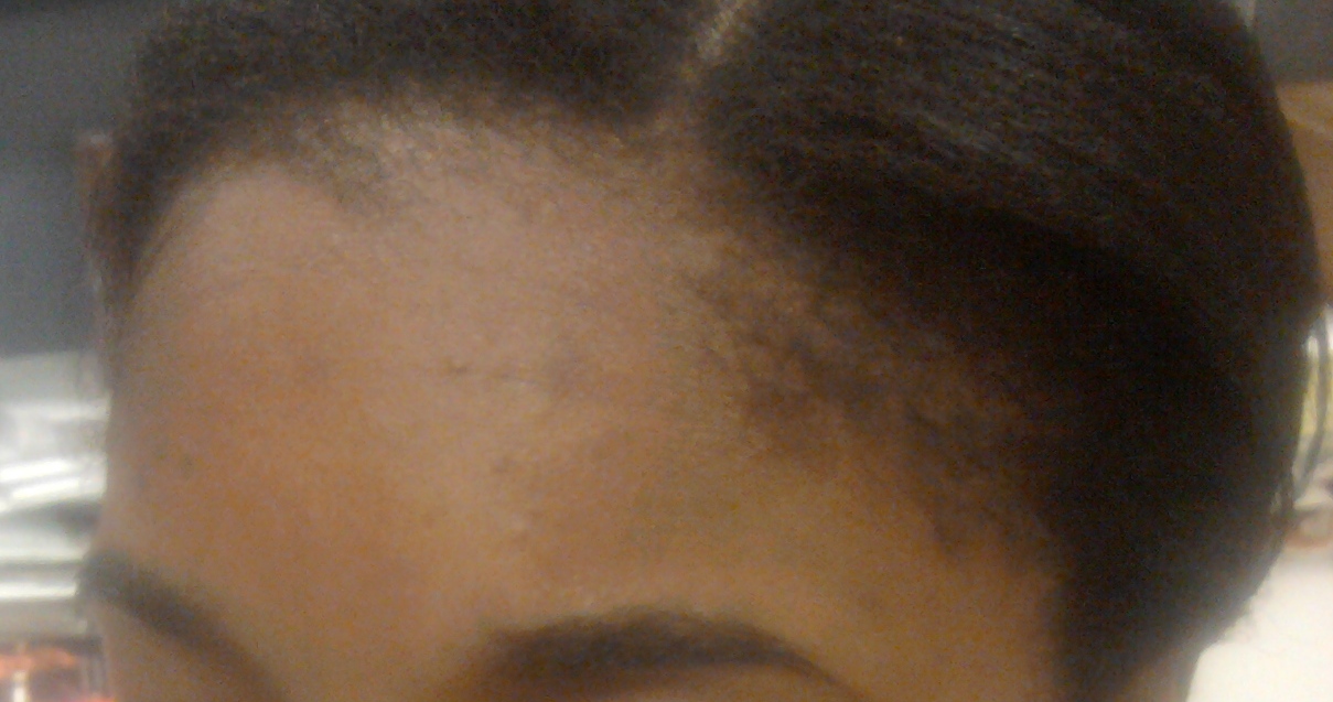 6FOOTLONGHAIR: My Poor Edges!