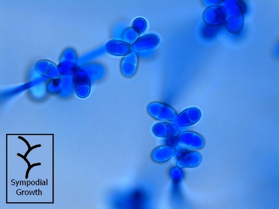 Fun With Microbiology (What's Buggin' You?): Trichothecium roseum
