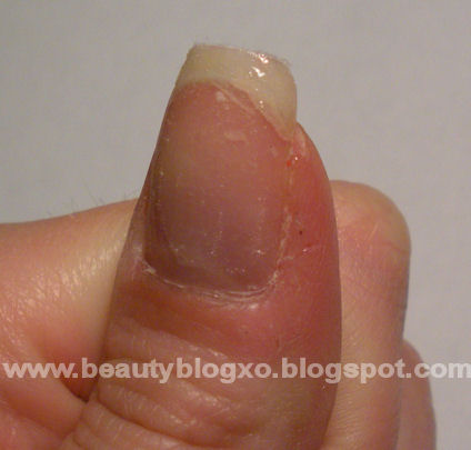 Drop Dead, Gorgeous: DIY: Repairing a Nail Tear