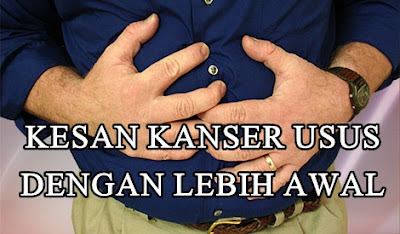 KANSER USUS:APA PUNCA DAN PENYEBABNYA?