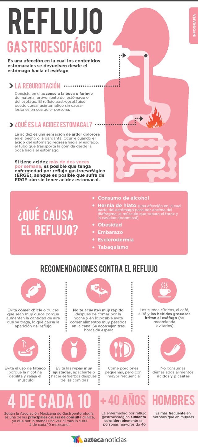 Infografias: El reflujo gastroesofágico