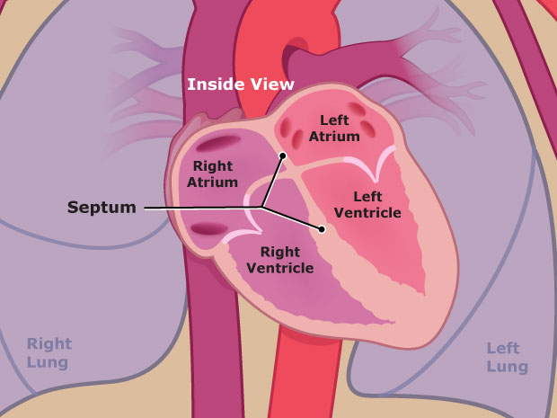 Atrial Septal defect (ASD) - How To Guide | Tips And Tricks | Tutorials ...