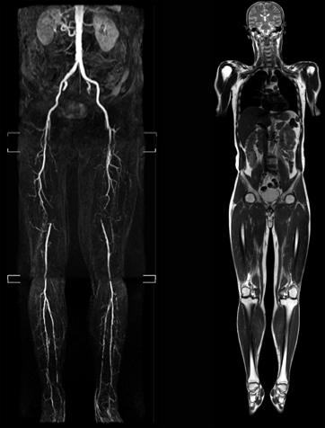 How MRI ( magnetic resonance imaging) works ? ~ MRI and Radiology ...