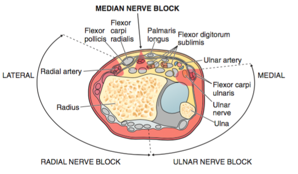 EM Didactic: Wrist Block (Landmark Technique)