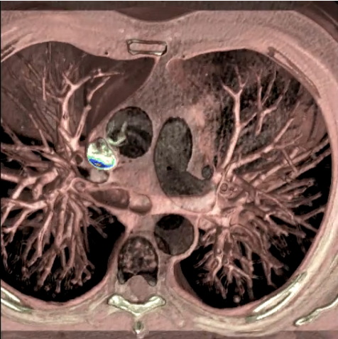 Electron Beam Scanners