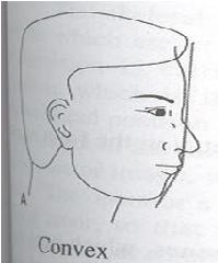 Dentistry lectures for MFDS/MJDF/NBDE/ORE: History taking and ...